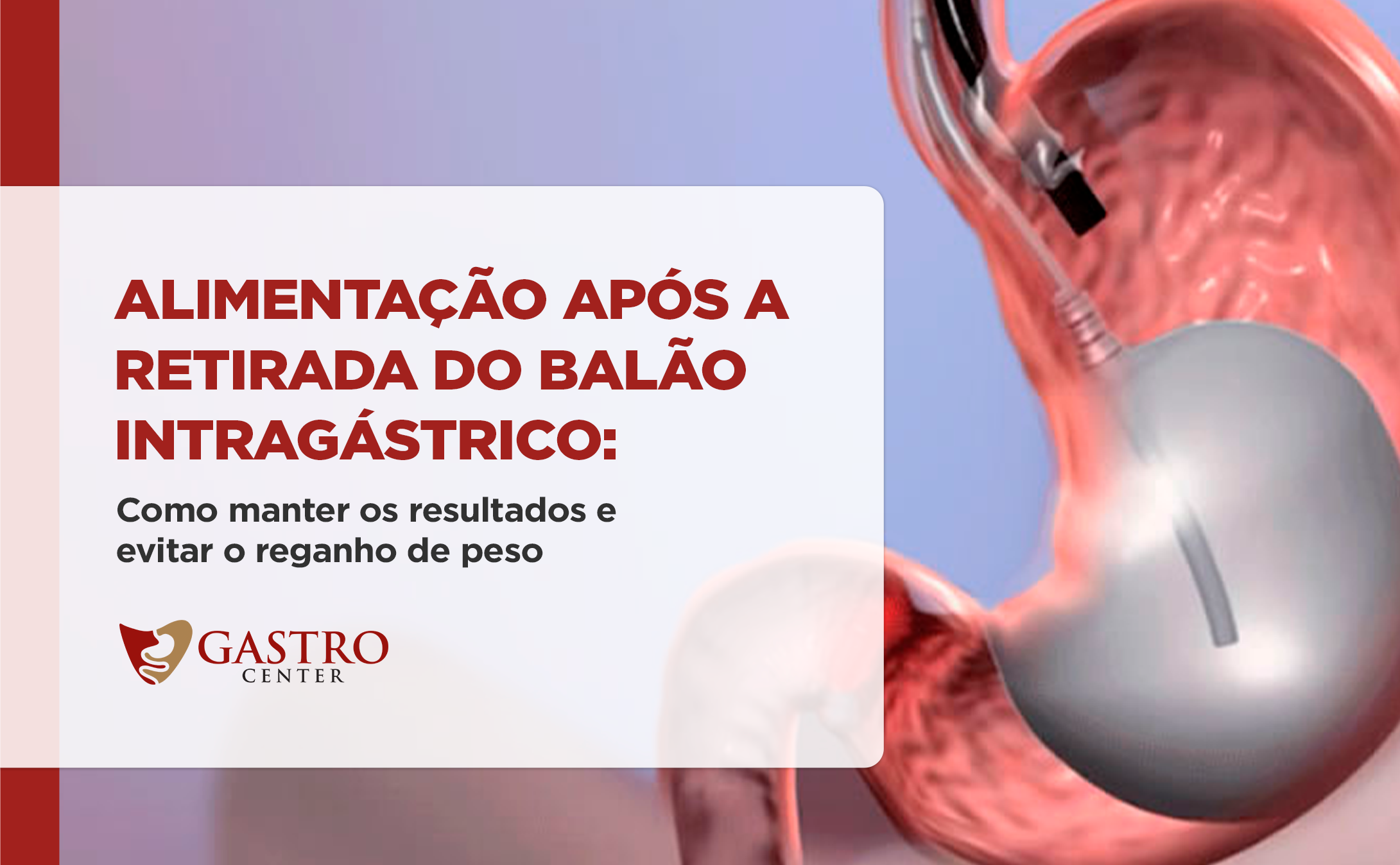 Alimentação após a Retirada do Balão Intragástrico: Como manter os ...